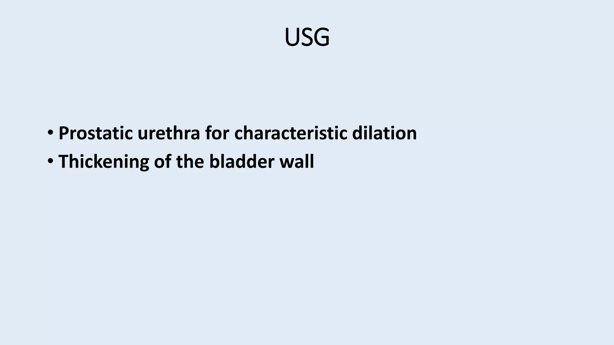 Posterior urethral valves | PPTX