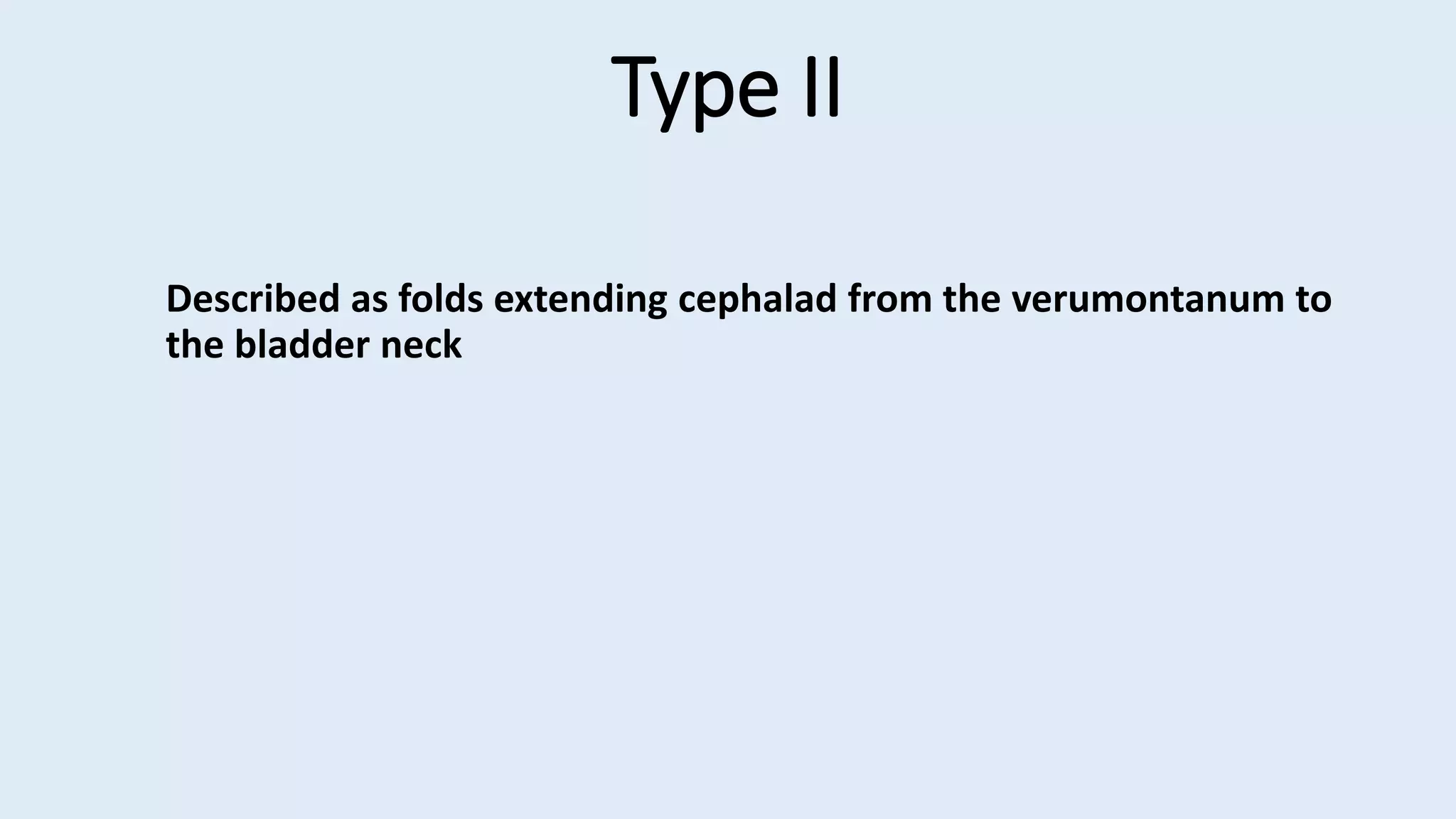 Posterior urethral valves | PPTX