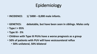 Posterior urethral valves | PPTX
