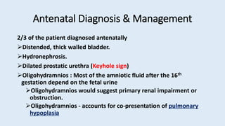 Posterior urethral valves | PPTX