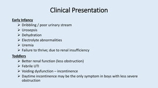 Posterior urethral valves | PPTX