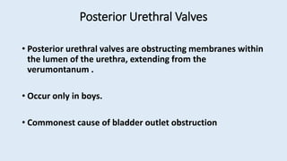 Posterior urethral valves | PPTX