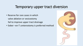 Posterior urethral valves | PPTX