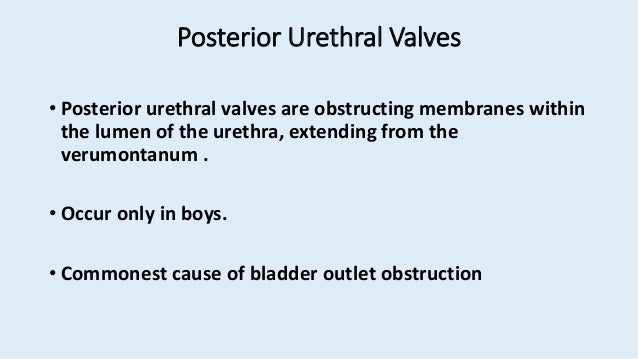 Posterior Urethral Valve Anatomy