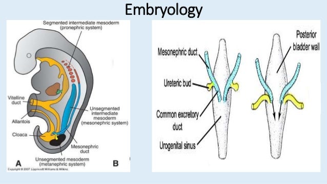 Posterior Urethral Valve Anatomy