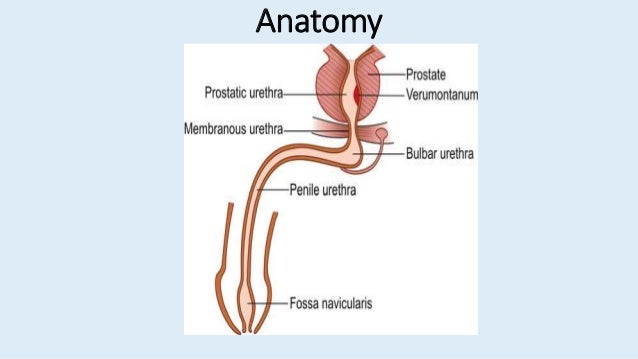 Diagrammatic Representation Of Posterior Urethral Valves diagrammatic-representation-of-posterior-urethral-valves