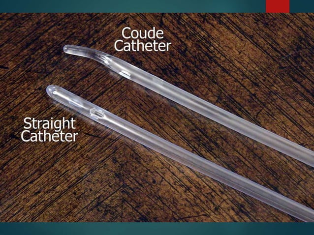 POSTERIOR URETERAL VALVES (PUV ) | PPTX
