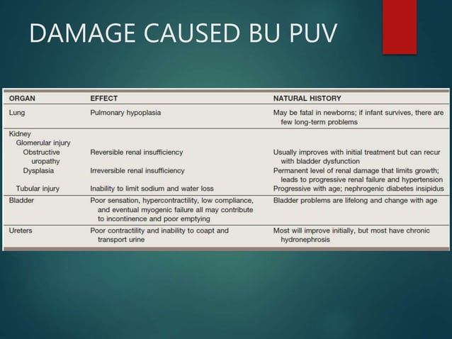 POSTERIOR URETERAL VALVES (PUV ) | PPTX
