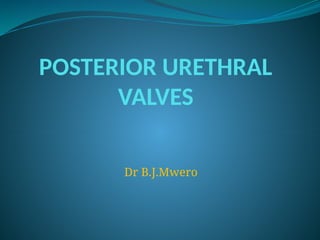POSTERIOR URETHRAL VALVES.pptx mwero.pptx