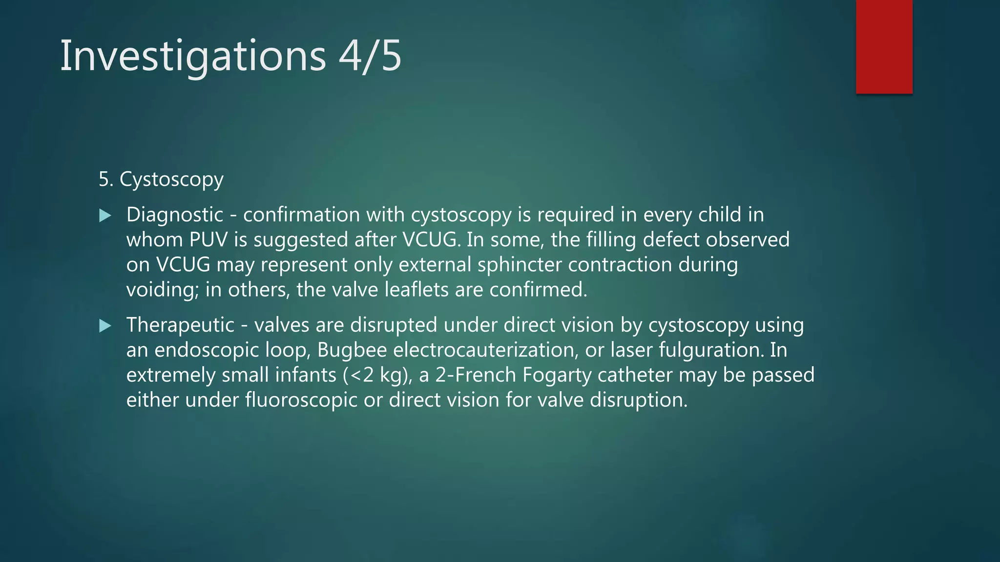 Posterior Urethral Valves | PPTX