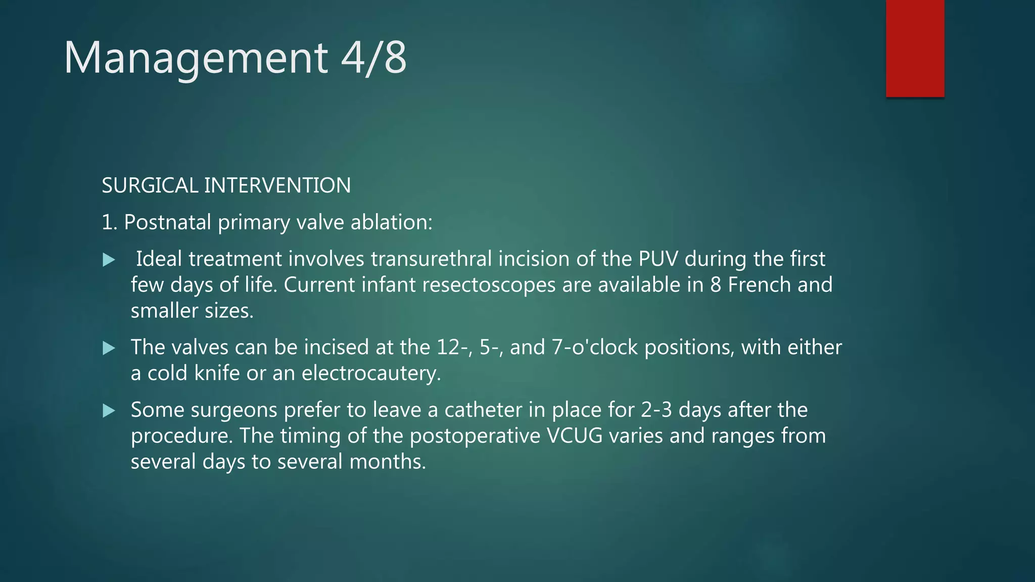 Posterior Urethral Valves | PPTX
