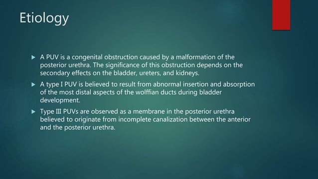 Posterior Urethral Valves | PPTX