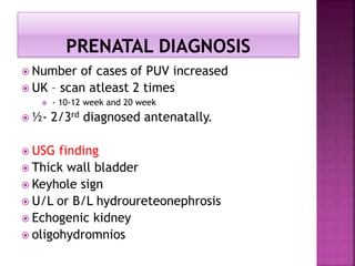 Posterior utrethral valve DR. PRITESH PATEL | PPT