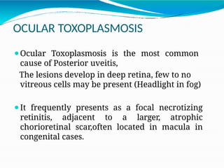 posterior uveitis Details-170908191351.pptx