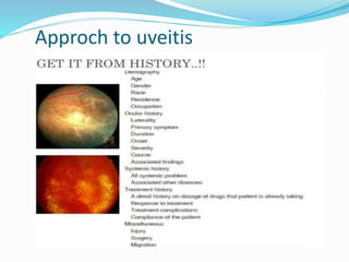 Posterior uveitis by Dr. VIJAY PRATAP VIPSY | PPTX