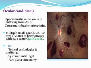 Posterior uveitis by Dr. VIJAY PRATAP VIPSY | PPTX