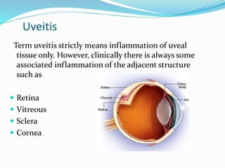 Posterior Uveitis