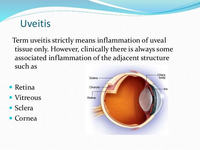 Posterior Uveitis By Dr Vijay Pratap Vipsy
