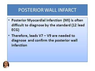Posterior wall infarct by dr bashir ahmed dar associate professor ...