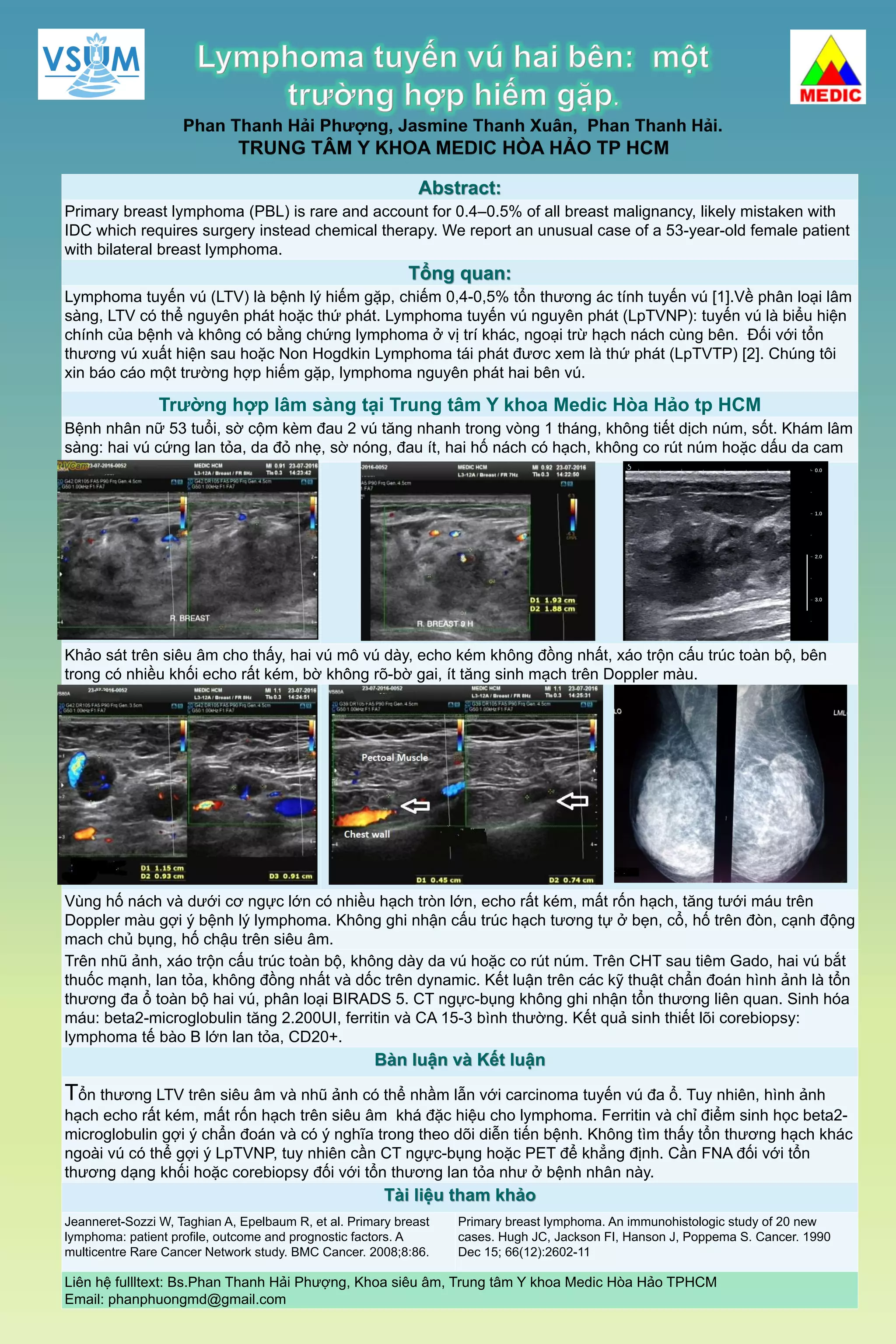 Lymphom 2 bên vú, Dr Phan Thanh Hai Phuong | PDF