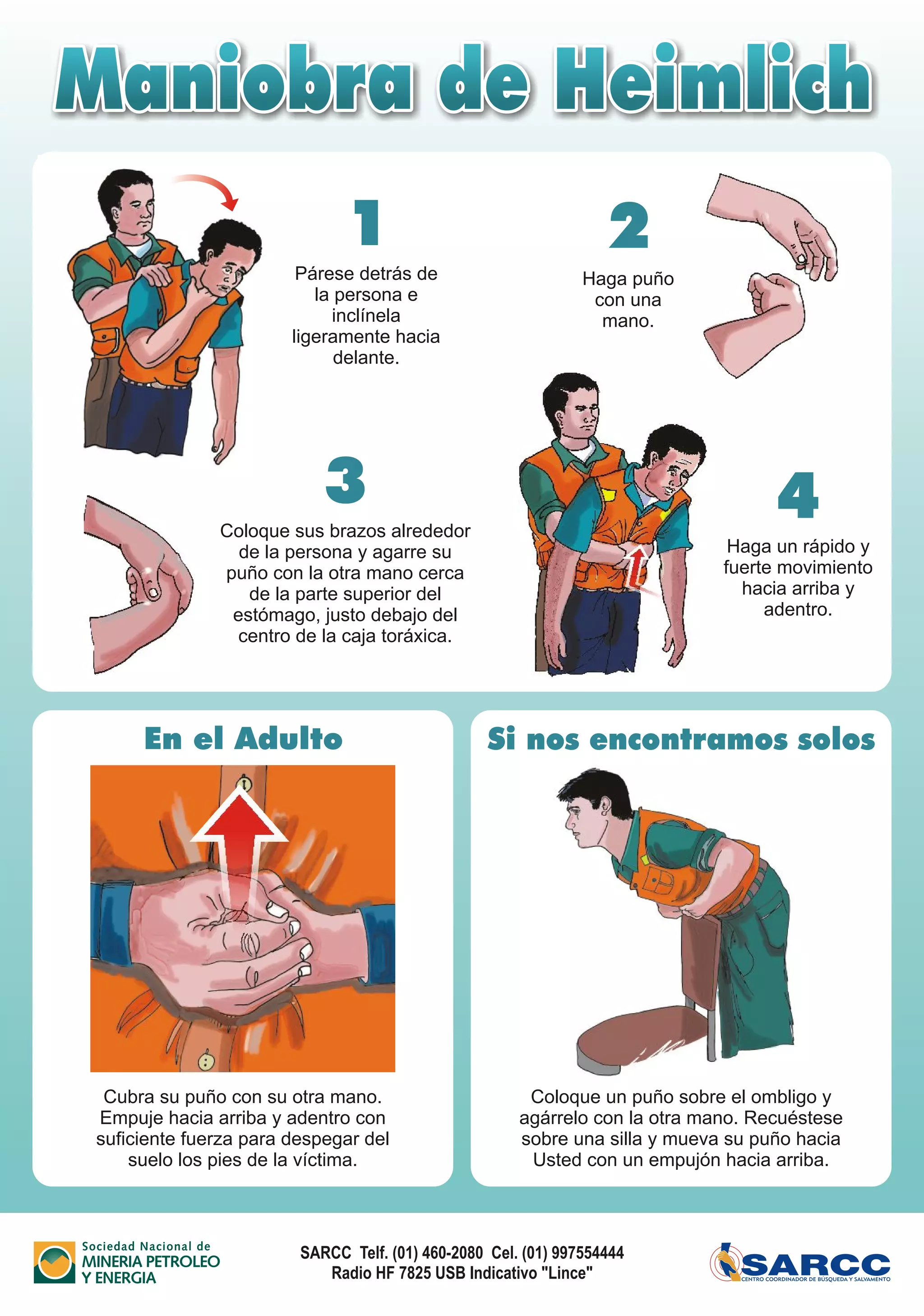 Poster maniobra de heimlich | PDF