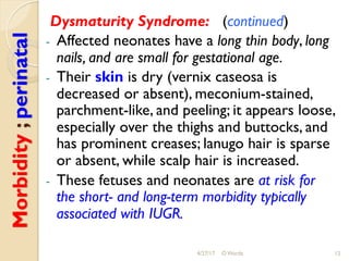 Posterm EBM- warda | PPT