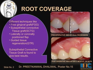 Dr. Preetkanwal Dhaliwal | PPT | Dental Health | Diseases and Conditions