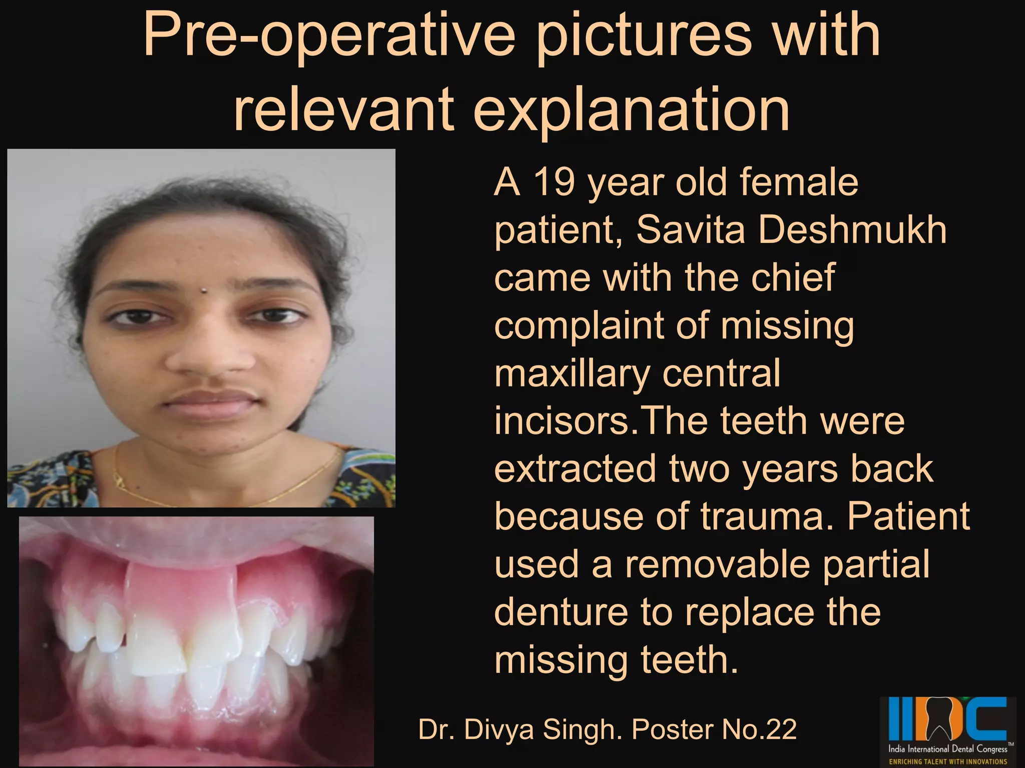 Dr. Divya Singh | PPT
