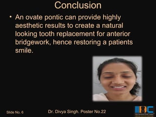 Dr. Divya Singh | PPT