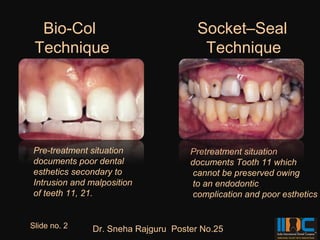 Dr. Sneha Rajguru | PPT