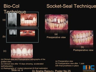 Dr. Sneha Rajguru | PPT