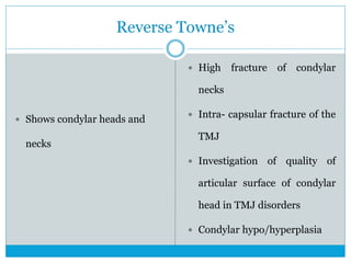 Postero anterior cephalometry | PPTX