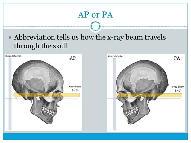 Postero anterior cephalometry | PPTX | Dental Health | Diseases and ...