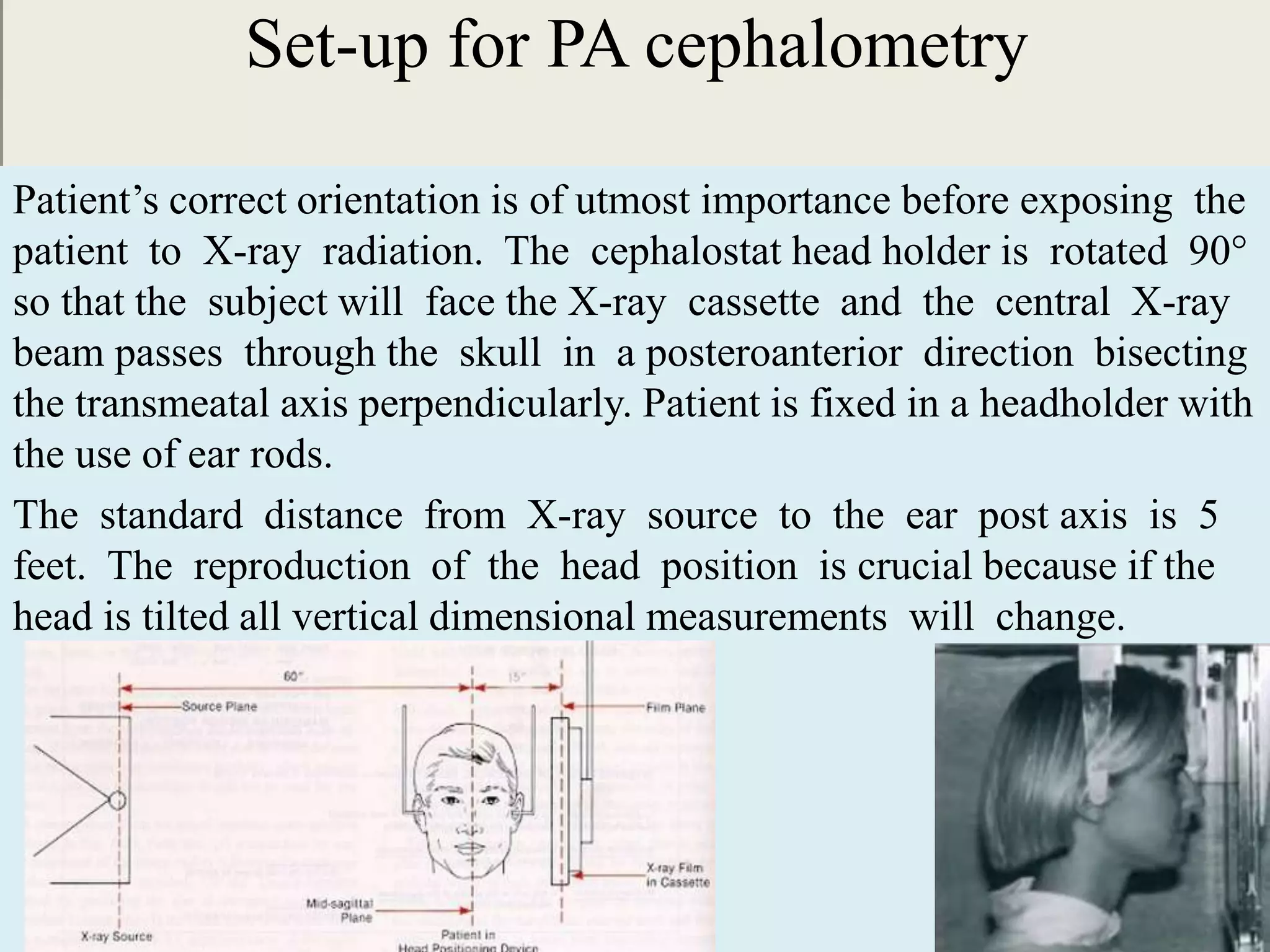 Postero anterior cephalometric _ mansoura university _ Egypt | PPTX