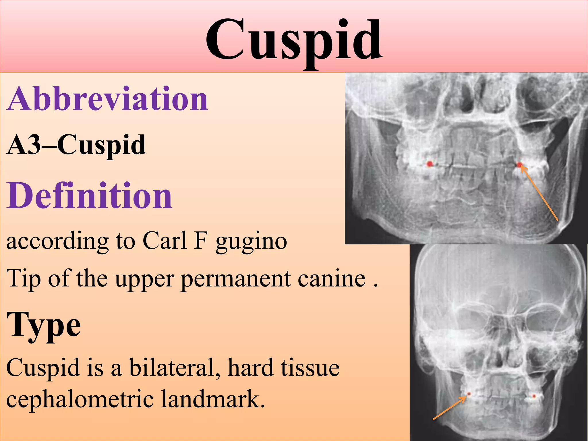 Postero anterior cephalometric _ mansoura university _ Egypt | PPTX