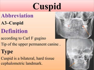 Postero anterior cephalometric _ mansoura university _ Egypt | PPTX