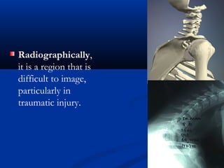 The midline and lateral parascapular extrapleural exposures | PPT