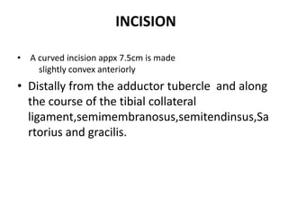 Posteromedial and posterolateral approach to knee | PPTX