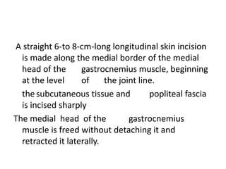 Posteromedial and posterolateral approach to knee | PPTX