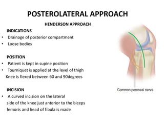 Posteromedial and posterolateral approach to knee | PPTX