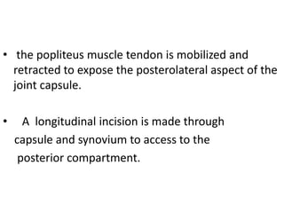 Posteromedial and posterolateral approach to knee | PPTX