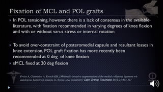 Posteromedial Corner (PMC) and Medial Collateral ligamnet (MCL ...