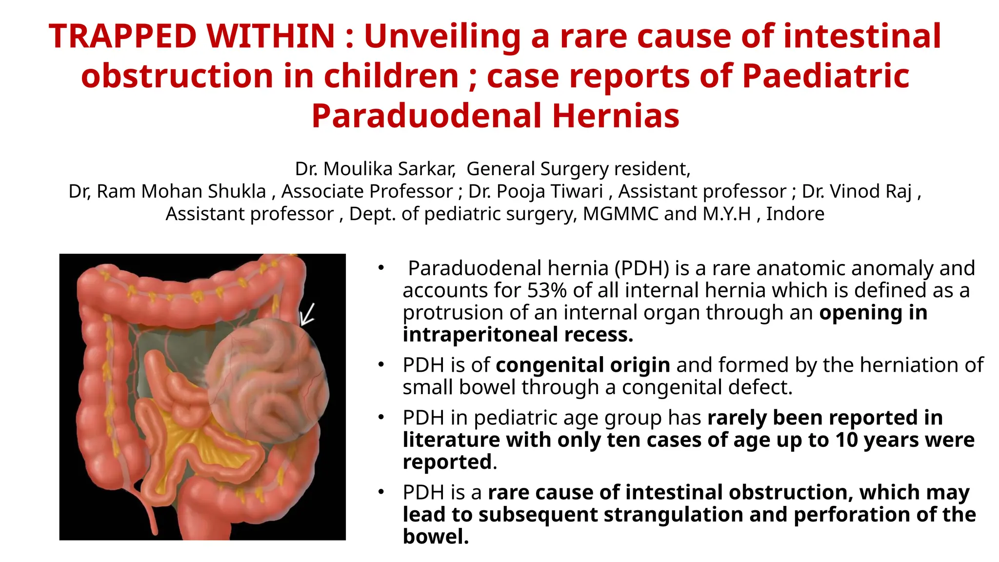 Paediatric Paraduodenal Hernia- rare cause of intestinal obstruction in ...