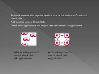 coombs test | PPTX