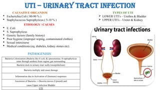 poster presentation.pptx urinary tract infections | PPTX