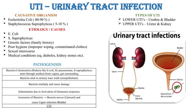 poster presentation.pptx urinary tract infections | PPTX