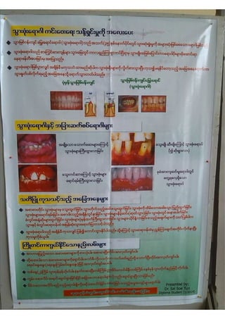 Posters for oral health care | PDF