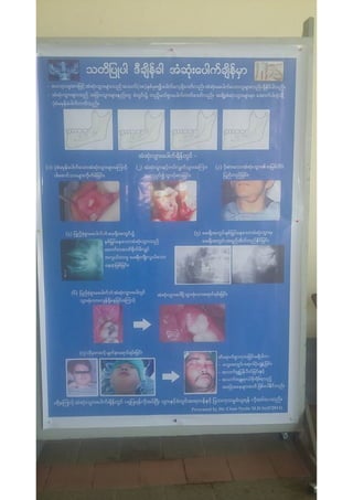 Posters for oral health care | PDF