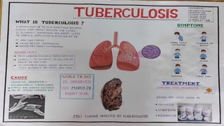 Posters on different diseases | PPT