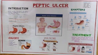 Posters on different diseases | PPT